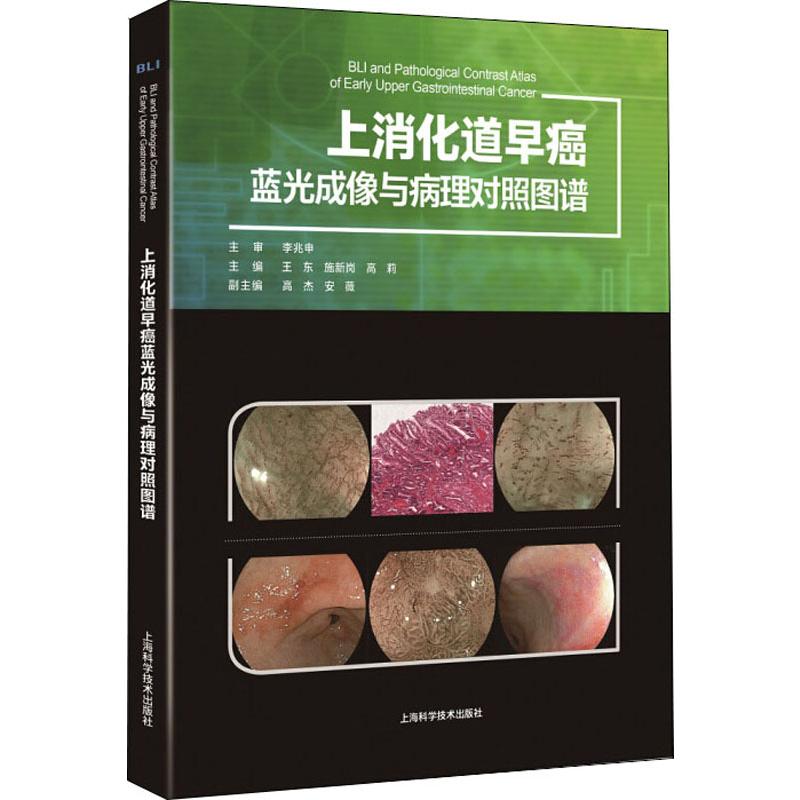 上消化道早癌蓝光成像与病理对照图谱