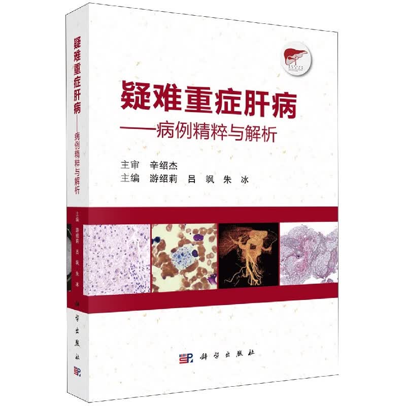 疑难重症肝病--病例精粹与解析