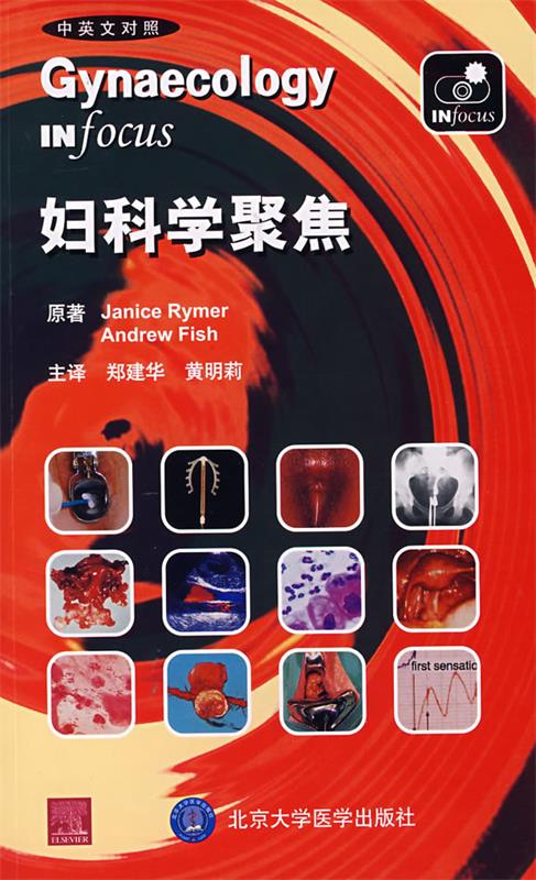 妇科学聚焦