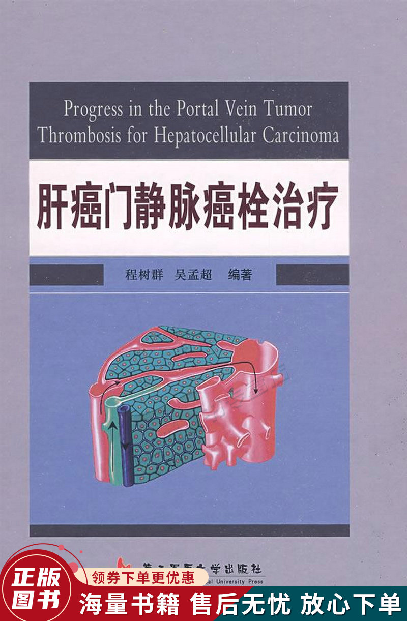 肝癌门静脉癌栓治疗