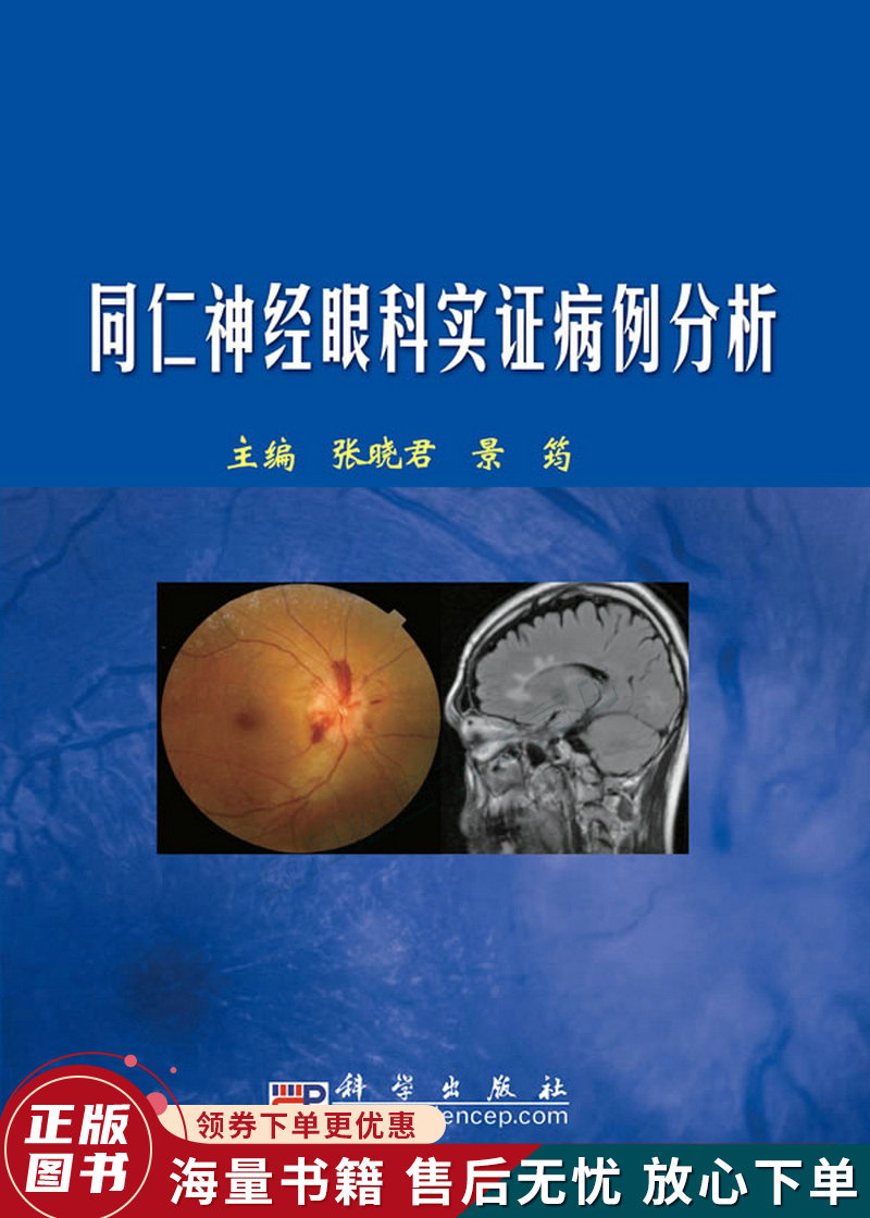 同仁神经眼科实证病例分析
