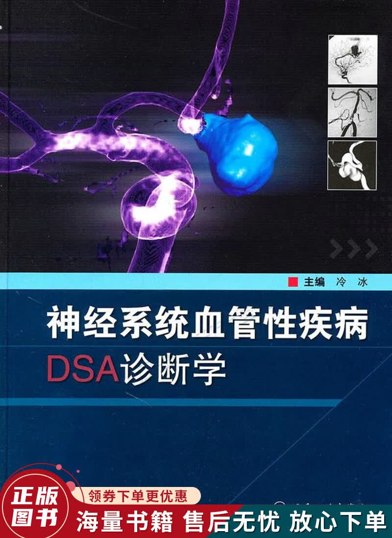 神经系统血管性疾病DSA诊断学