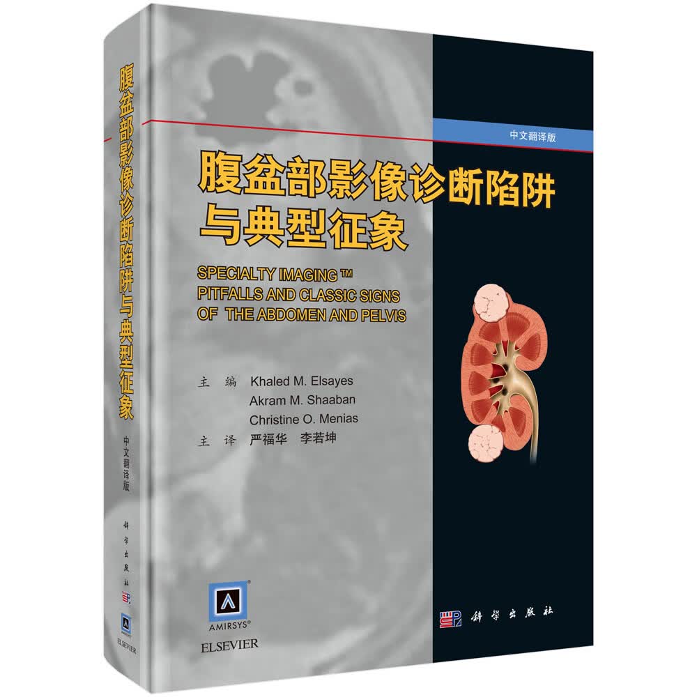 腹盆部影像诊断陷阱与典型征象