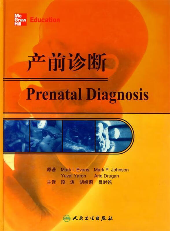 产前诊断