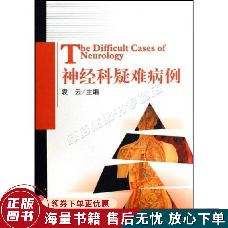 神经科疑难病例