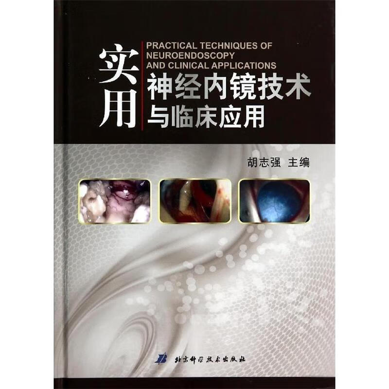 实用神经内镜技术与临床应用
