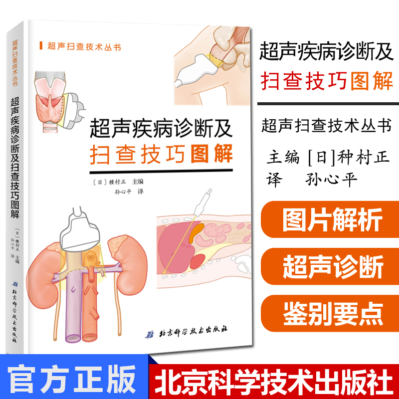 超声疾病诊断及扫查技巧图解 超声扫查技术丛书