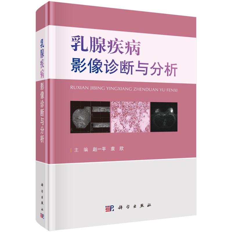 乳腺疾病影像诊断与分析(精)