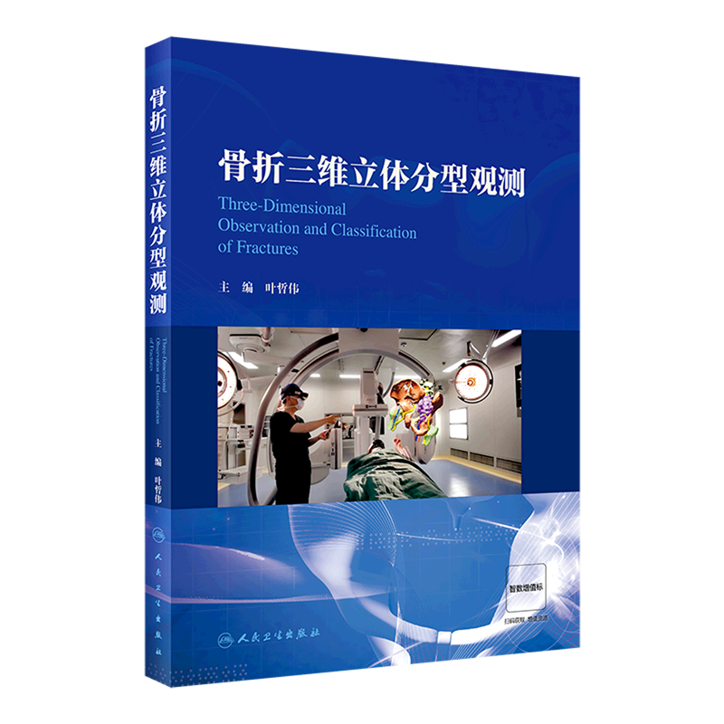 骨折三维立体分型观测(精)