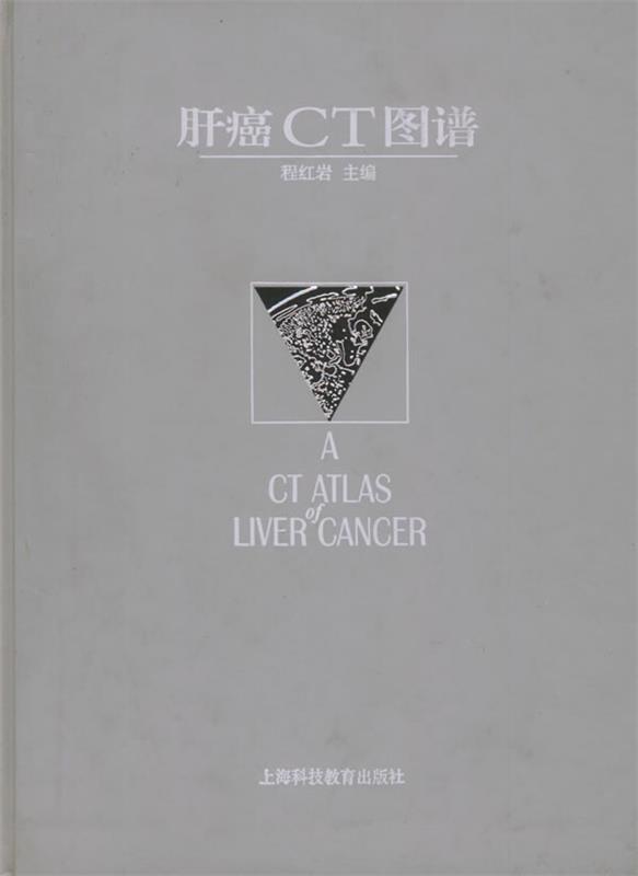 肝癌CT图谱 程红岩 主编