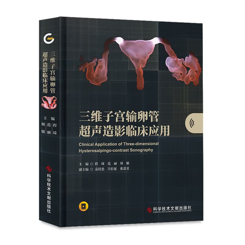 三维子宫输卵管超声造影临床应用 程琦范丽周敏 著 妇产科