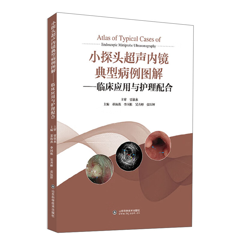 小探头超声内镜典型病例图解