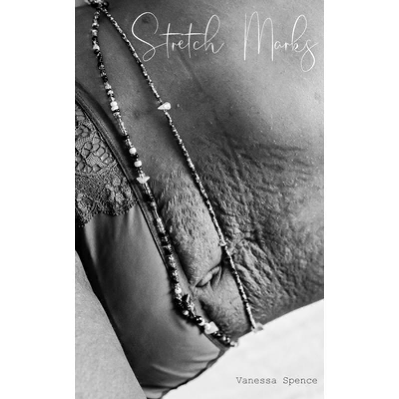 Stretch Marks
