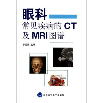 眼科常见疾病的CT及MRI图谱 李若溪 著