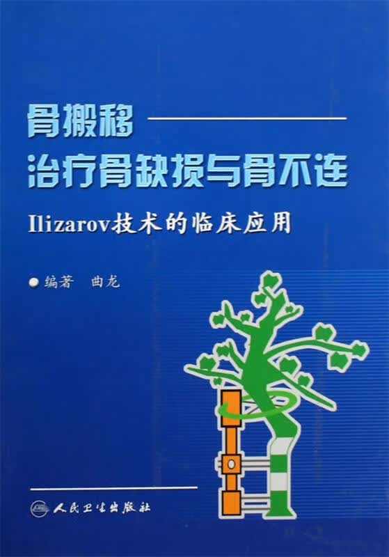 速发》骨搬移治疗骨缺损与骨不连-Ilizarov技术的临床应用人民卫生出版社