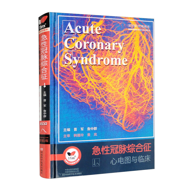 急性冠脉综合征：心电图与临床