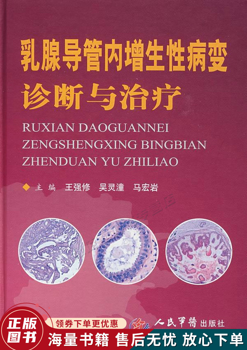 乳腺导管内增生性病变诊断与治疗