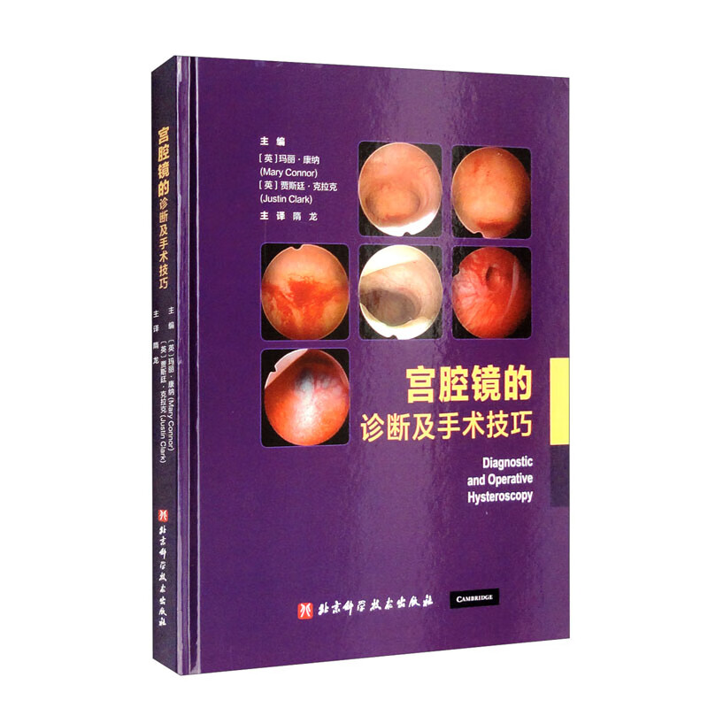 宫腔镜的诊断及手术技巧