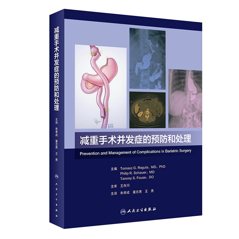 减重手术并发症的预防和处理