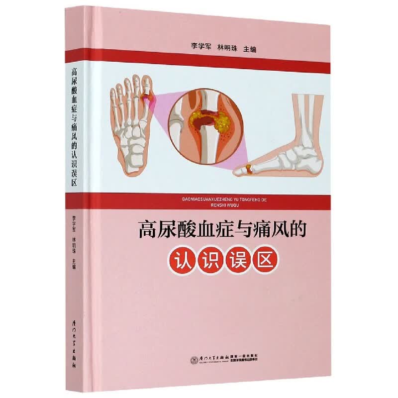 高尿酸血症与痛风的认识误区 精