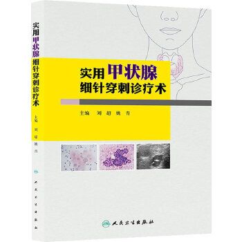 实用甲状腺细针穿刺诊疗术