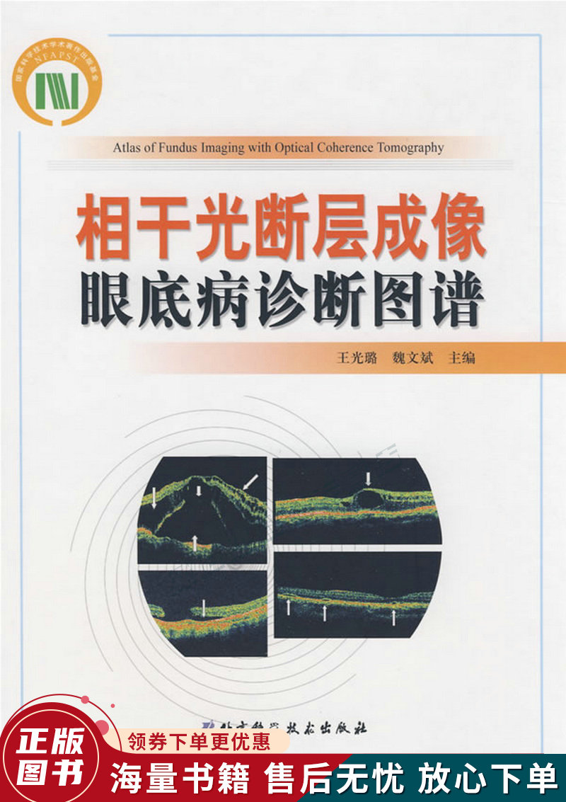 相干光断层成像眼底病诊断图谱