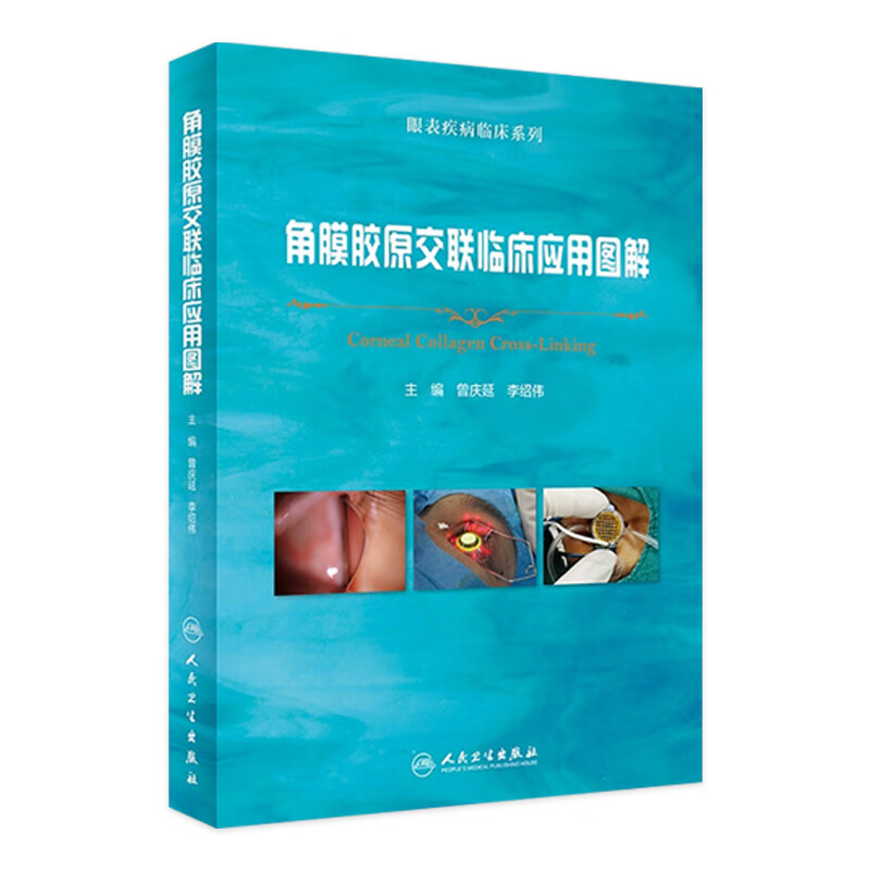 角膜胶原交联临床应用图解 2023年5月参考书 9787117346566