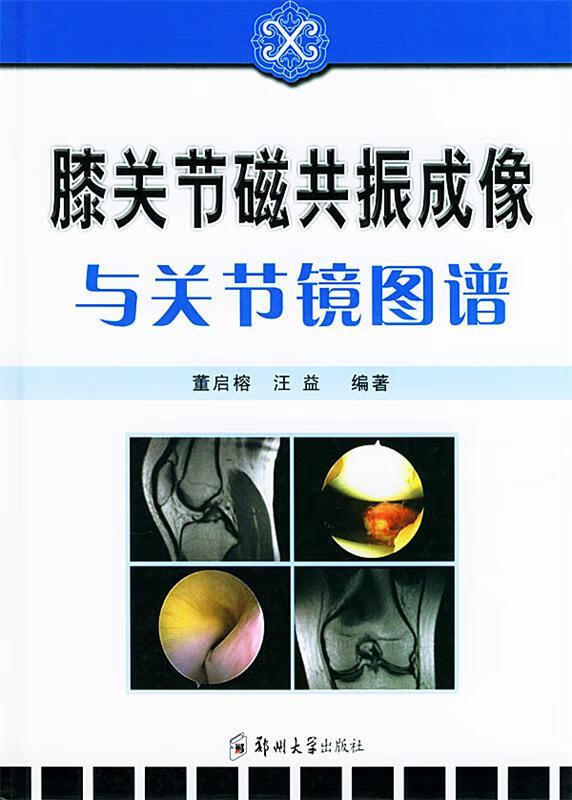 膝关节磁共振成像与关节镜图谱
