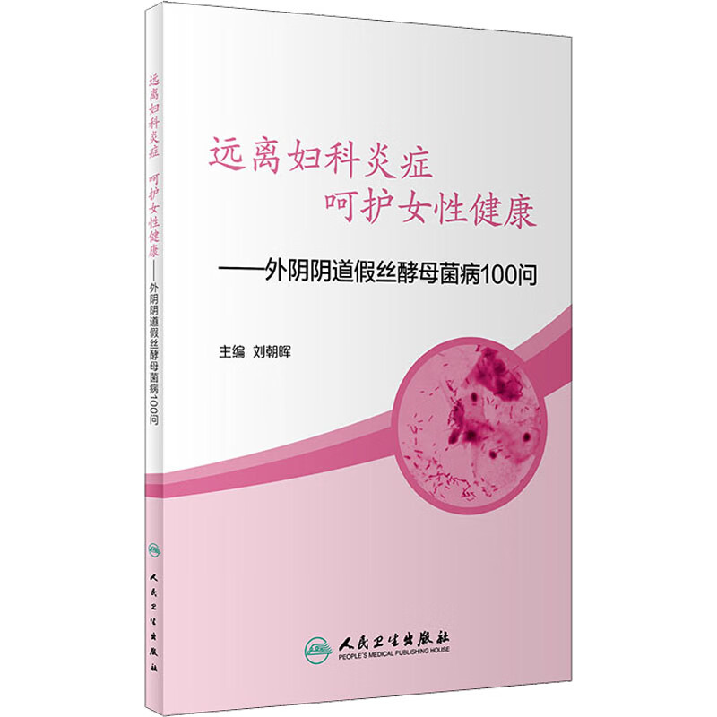远离妇科炎症 呵护女性健康——外阴阴道假丝酵母菌病100问 刘朝晖 编 书籍
