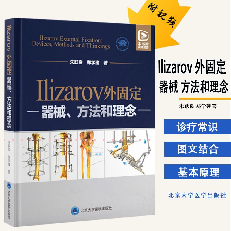 Ilizarov 外固定 器械 方法和理念朱跃良 郑学建著 基本原理基本部件胫骨横向搬移和相关技术北京大学医学出版社