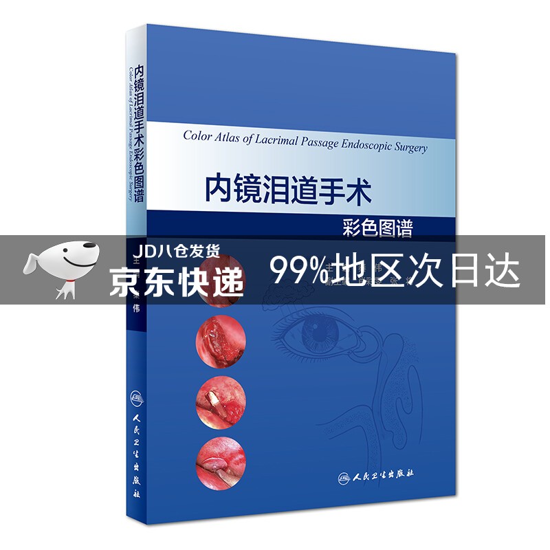 内镜泪道手术彩色图谱