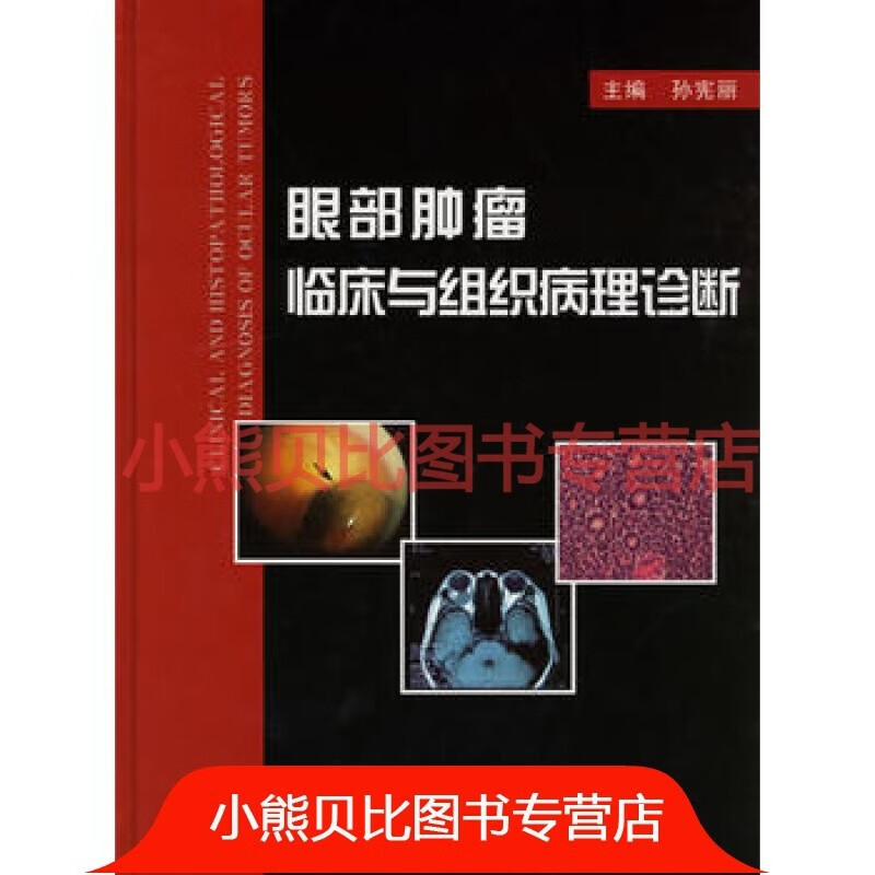 眼部肿瘤临床与组织病理诊断
