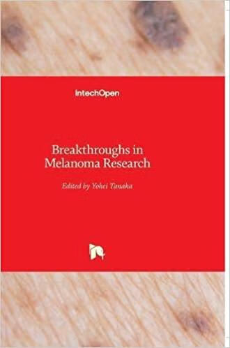 Breakthroughs in Melanoma Research