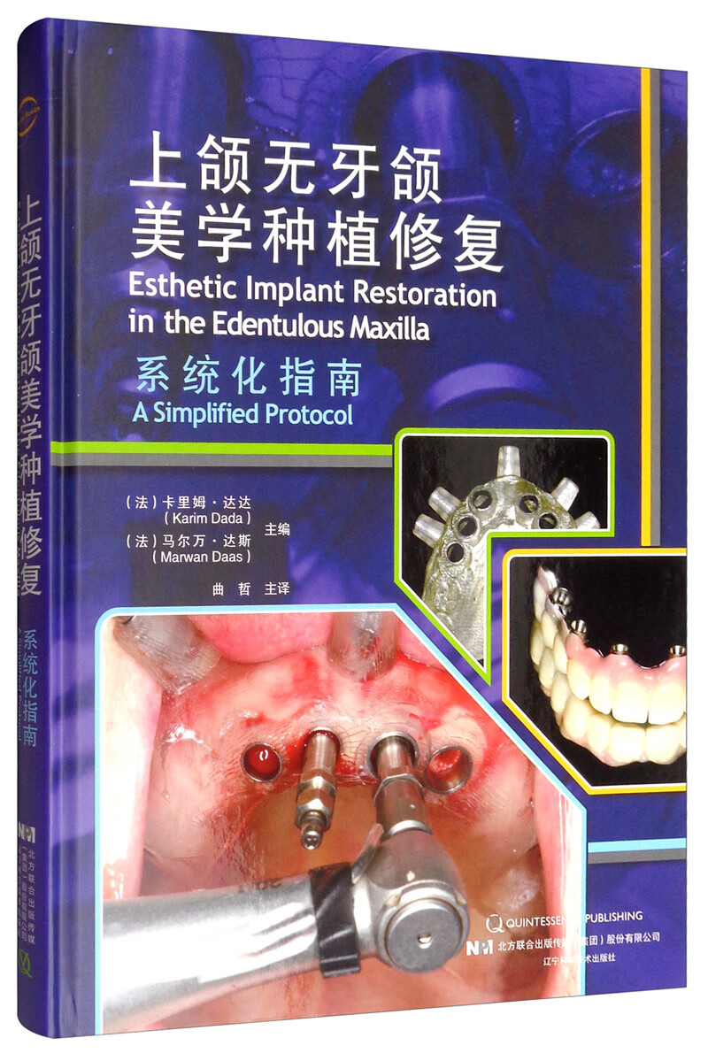 上颌无牙颌美学种植修复系统化指南 书籍