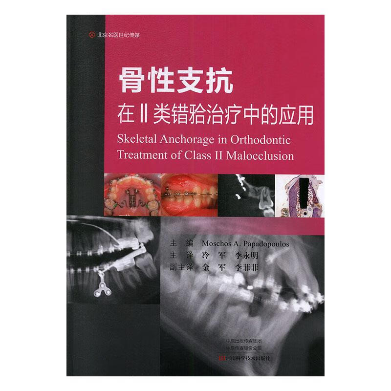 骨性支抗在Ⅱ类错牙合中的应用 医学 Moschos A. Papadopoulos, DDS主编 河
