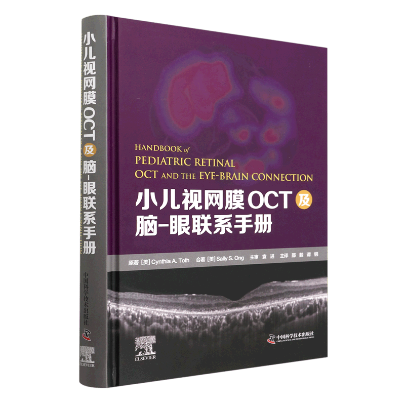 小儿视网膜OCT及脑-眼联系手册(精)