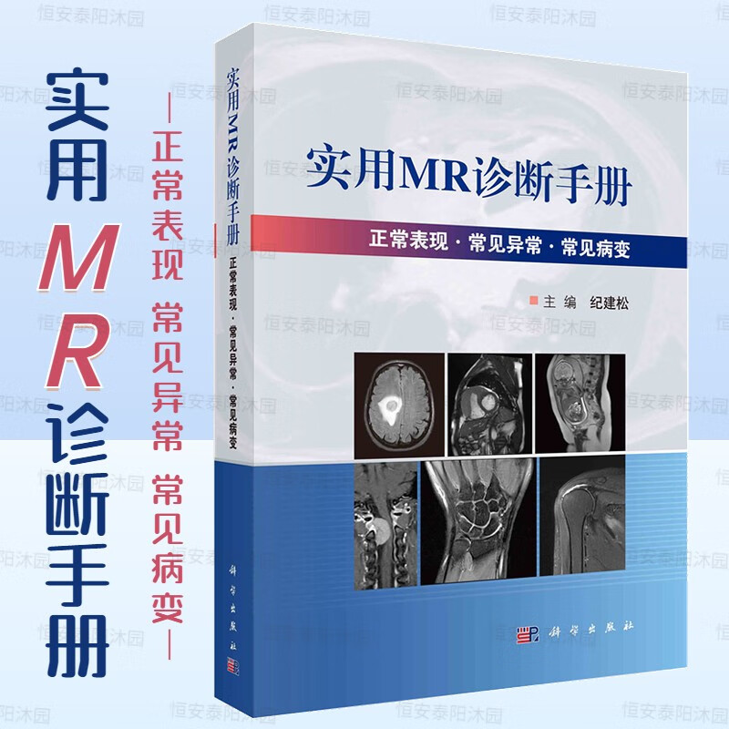 实用MR诊断手册 纪建松主编磁共振成像原理成像序列与技术及成像技术临床应用临床内科MRI诊断影像医学科学出版社