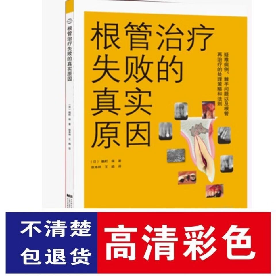 根管治疗失败的真实原因