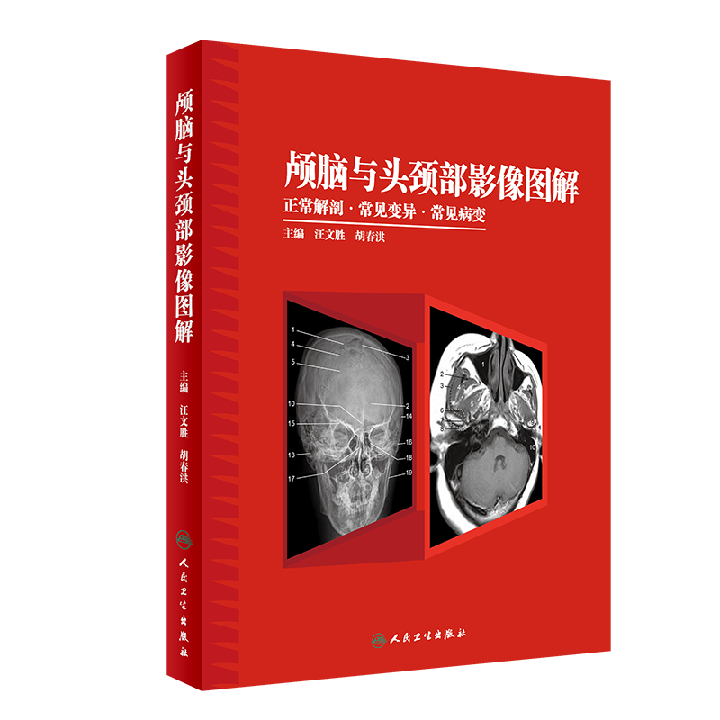 现货 颅脑与头颈部影像图解正常解剖常见变异常见病变汪文胜胡春红影像解剖与临床图解临床医学丛书影