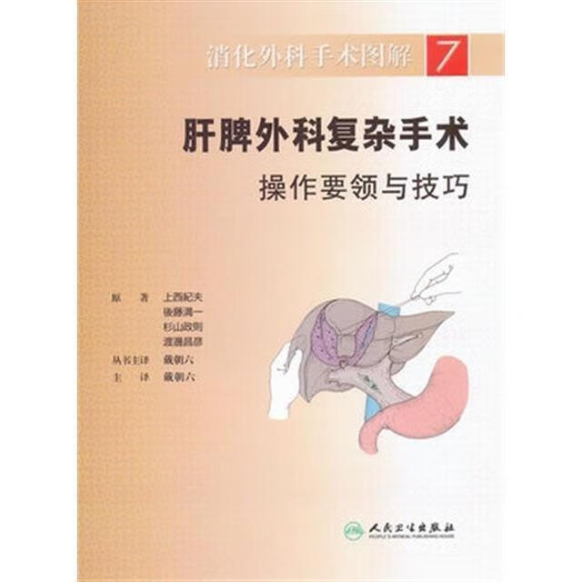 消化手术图解 7 肝脾复杂手术操作要领与技