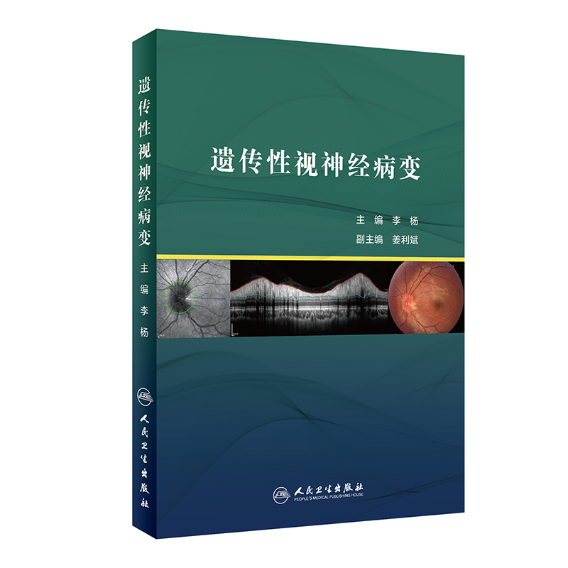 遗传性视神经病变