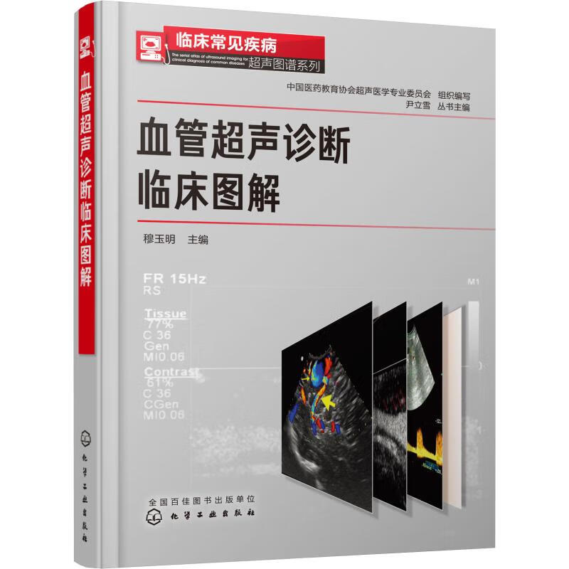 血管超声诊断临床图解