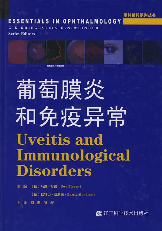 葡萄膜炎和免疫异常