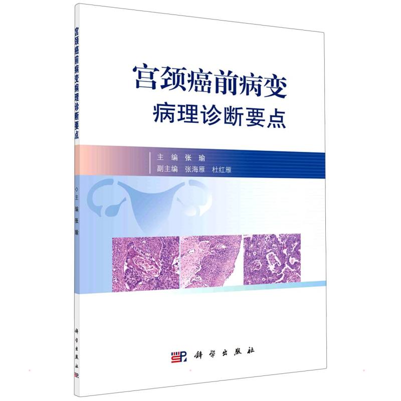 宫颈癌前病变病理诊断要点 图书