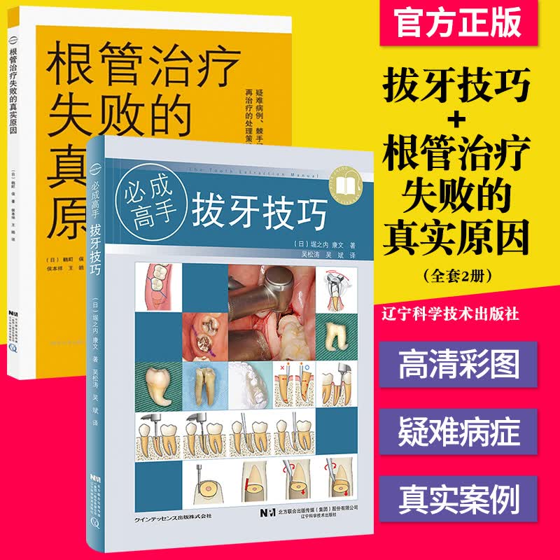 2本 拔牙技巧 必成高手+根管治疗失败的真正原因 口腔医学书籍 临床医学 牙体牙髓病预防诊断牙齿种植畸形矫 辽宁科学技术出版社