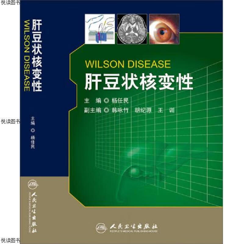 肝豆状核变性(签名本)