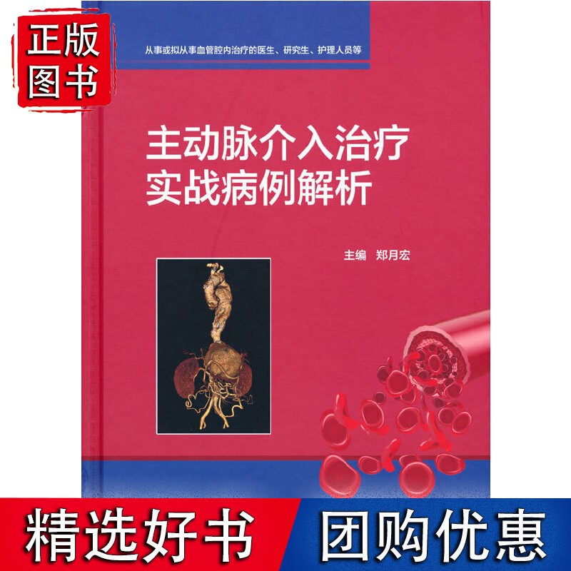 主动脉介入治疗实战病例解析