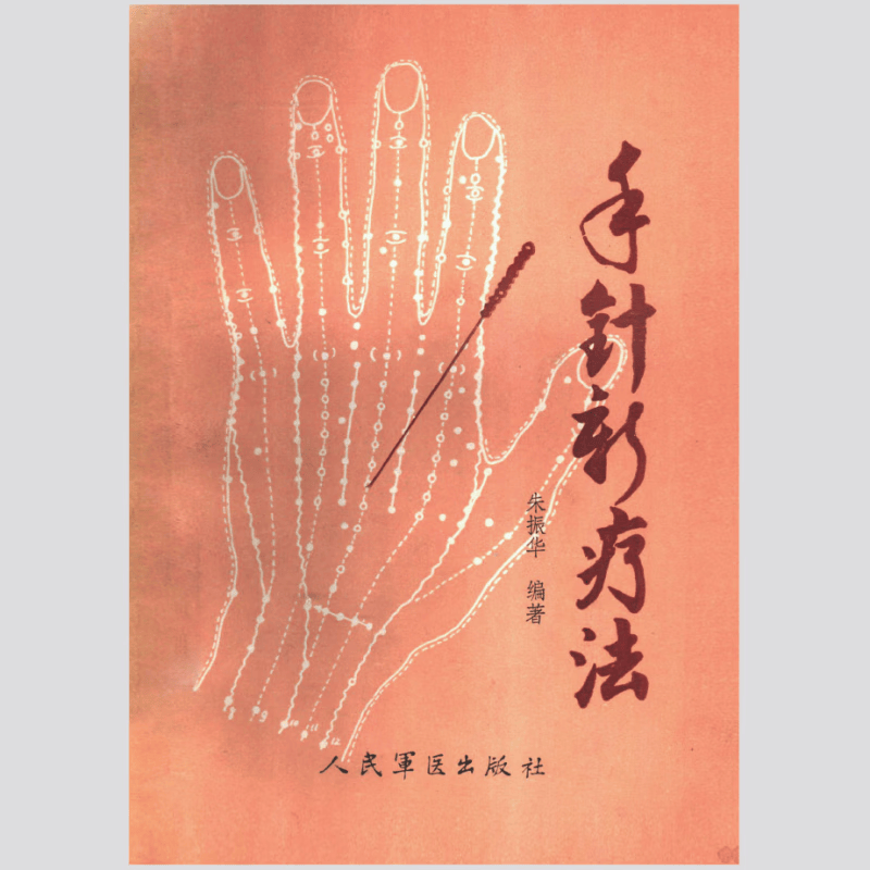 手针新疗法 朱振华编著 人民军医出版社 1990年04月第1版 107页