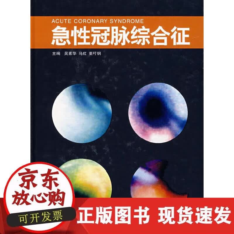【现货】急性冠脉综合征