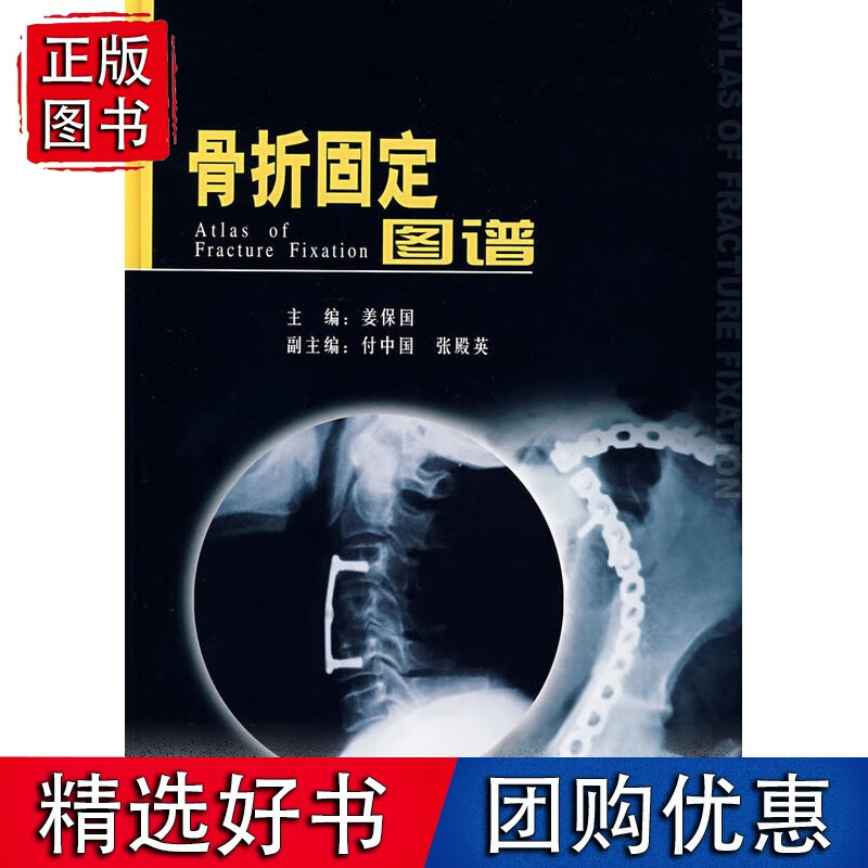 骨折固定图谱